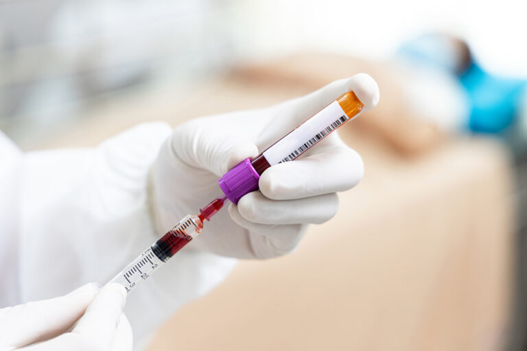 ACRS療法の効果-PRP療法との違いは?|クリニークハル大阪梅田