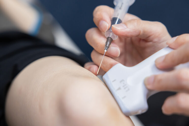 PR療法･PRP-FD注射の効果とメリット･デメリット|クリニークハル大阪梅田